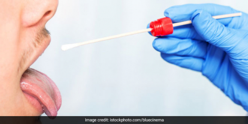 Pune Based Mylab Launches 'Compact XL' To Automate Molecular Diagnostic ...