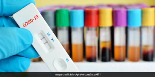 First Cost, Time-Effective ‘CRISPR’ Test For COVID-19 Gets Nod For ...