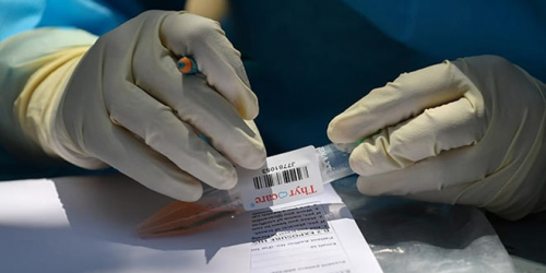 Dr Reddy's Laboratories Seeks DCGI Permission To Conduct Phase III ...