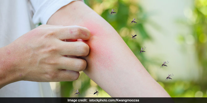 The Rise Of Dengue: Know All About The Causes, Symptoms And Measures To ...